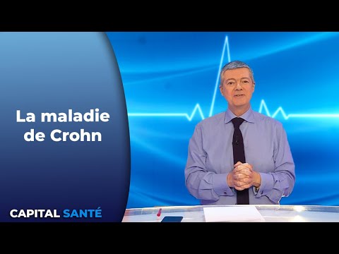 La maladie de Crohn