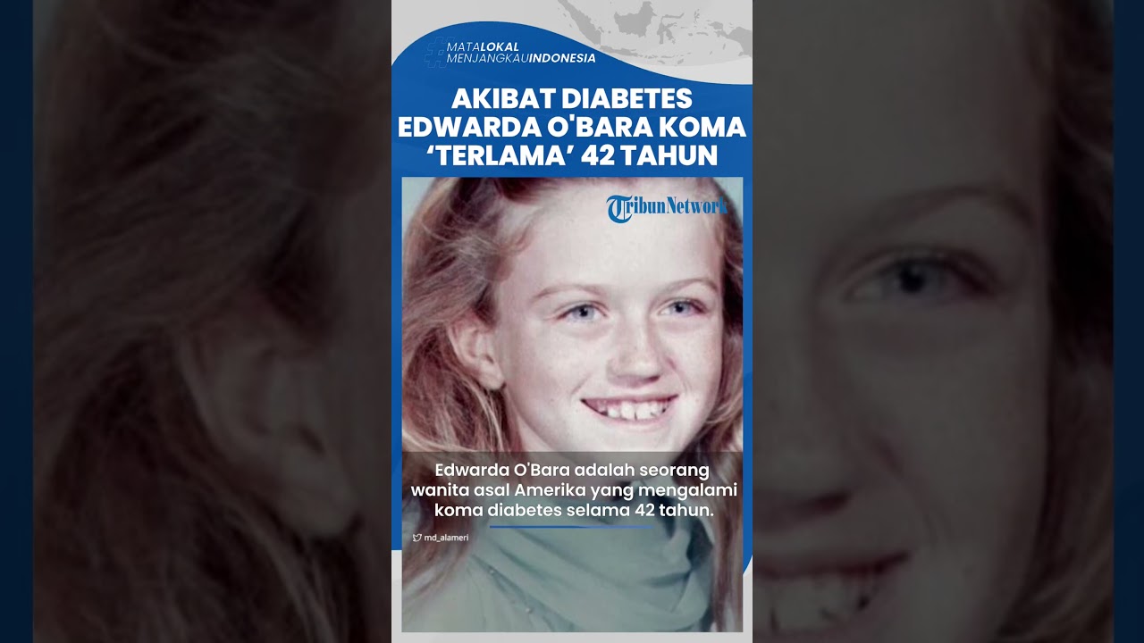 Edwarda O'Bara Koma Terlama 42 Tahun akibat Diabetes, Masih Tertidur ...
