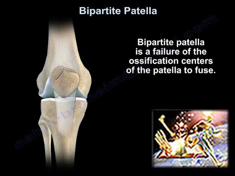 Bipartite Patella – Dr. Nabil Ebraheim's Blog