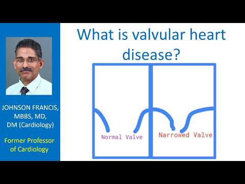 What is valvular heart disease