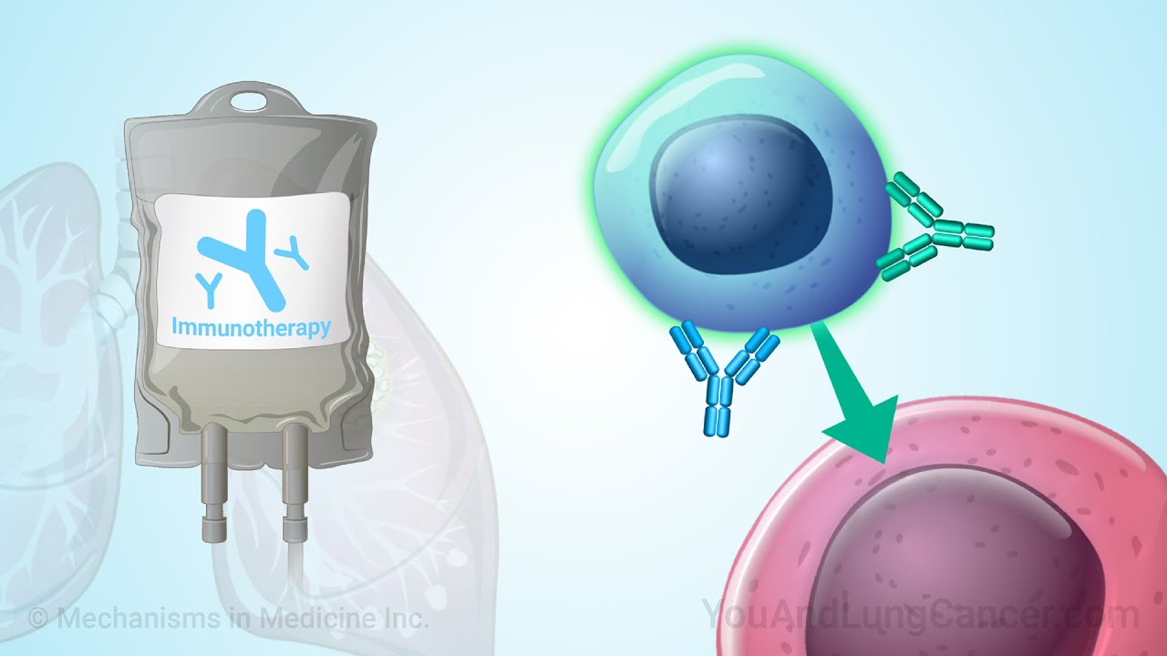 Understanding Immunotherapy for Lung Cancer - updated 2025