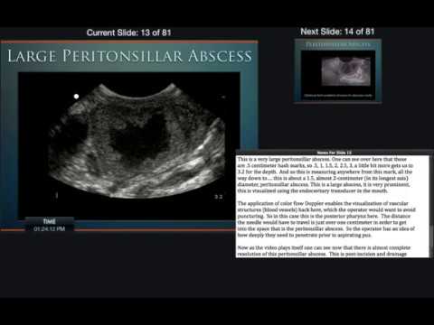 Ultrasound Head and Neck
