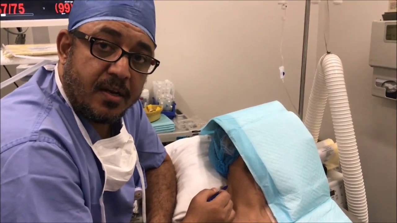 US-guided spinal accessory nerve block