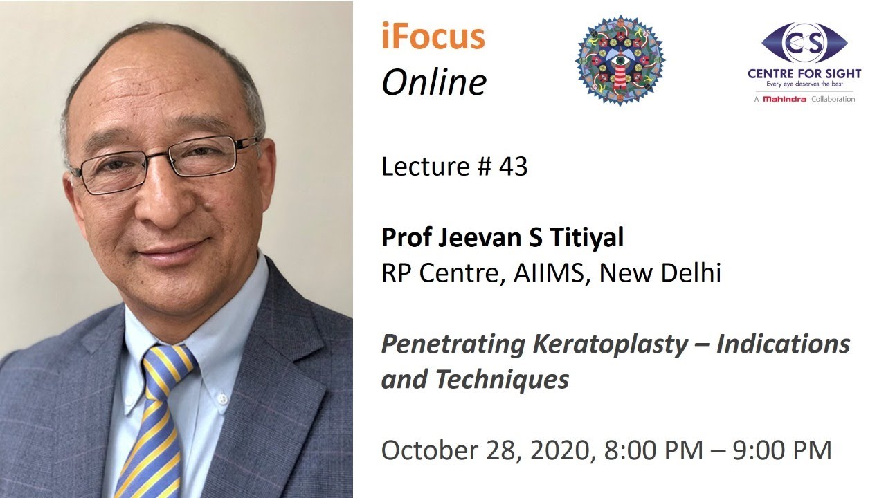 iFocus Online, Session 43