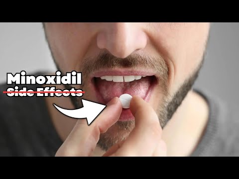 How to Avoid Oral MINOXIDIL Side Effects | with AL GARRIDO