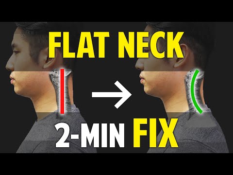 Fix Flat Neck(Cervical Kyphosis)|Neck Correction|Balancing Exercises