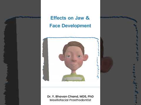 Thumb Sucking Alert: What It's Doing to Your Child's Smile | Irregular teeth | Dr. Bhavan Chand