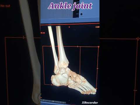 Ankle joint | 3D view | Anatomical view of lower limb | CT Scan View #ctscanning #anklejoint