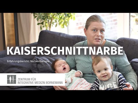 Behandlung Kaiserschnittnarbe // Eine Patientin berichtet // »Weil Narben nicht nur optisch stören«
