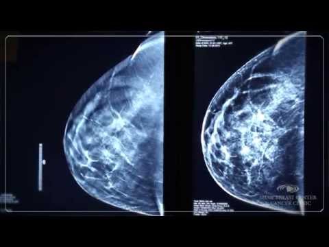 Shaw Breast Center & Cancer Clinic - 3D Mammography