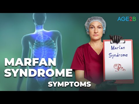 Marfan Syndrome. Symptoms