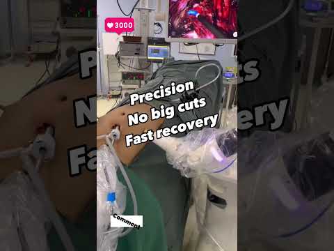 🎮 this is not VIDEO GAME_Hernia Surgery with Robotic operation in India 🇮🇳