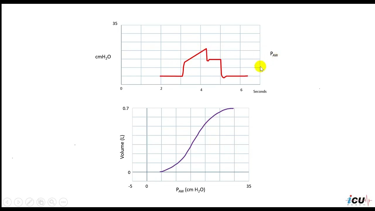 Understanding the Importance of Stress Index in ARDS
