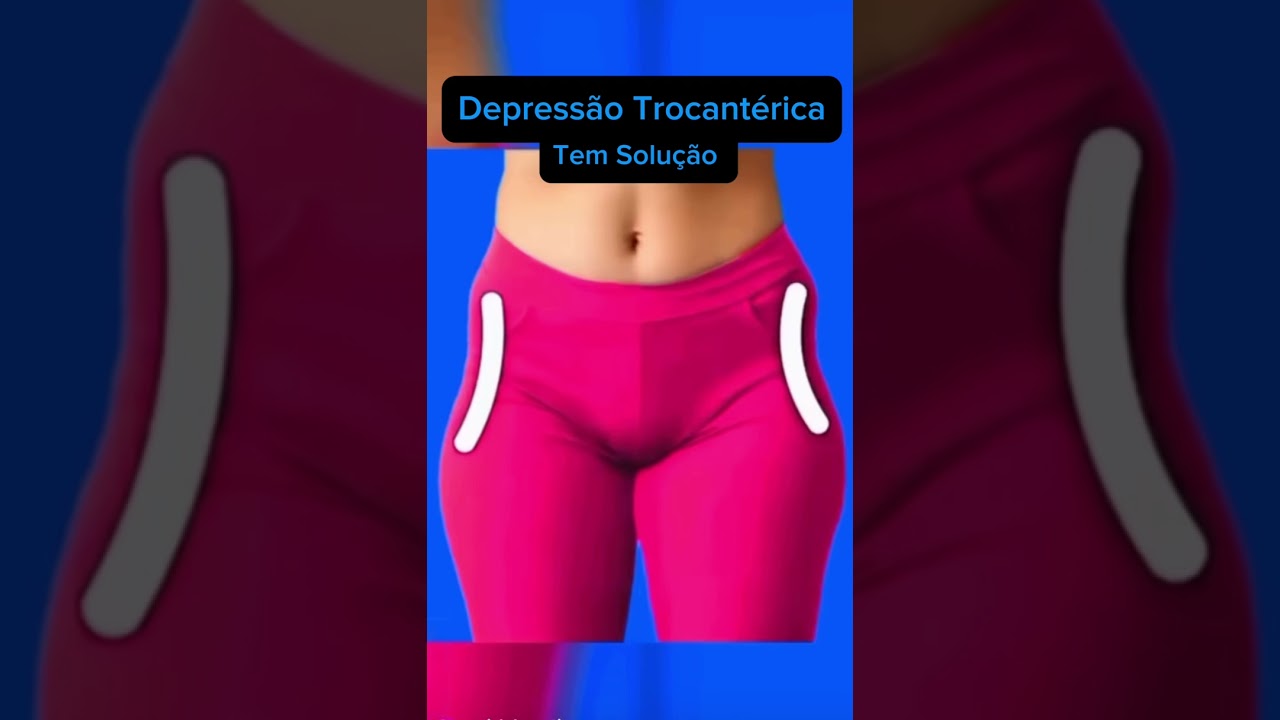 🔥 Depressão Trocantérica (Hip Dips): Como Corrigir de Vez!