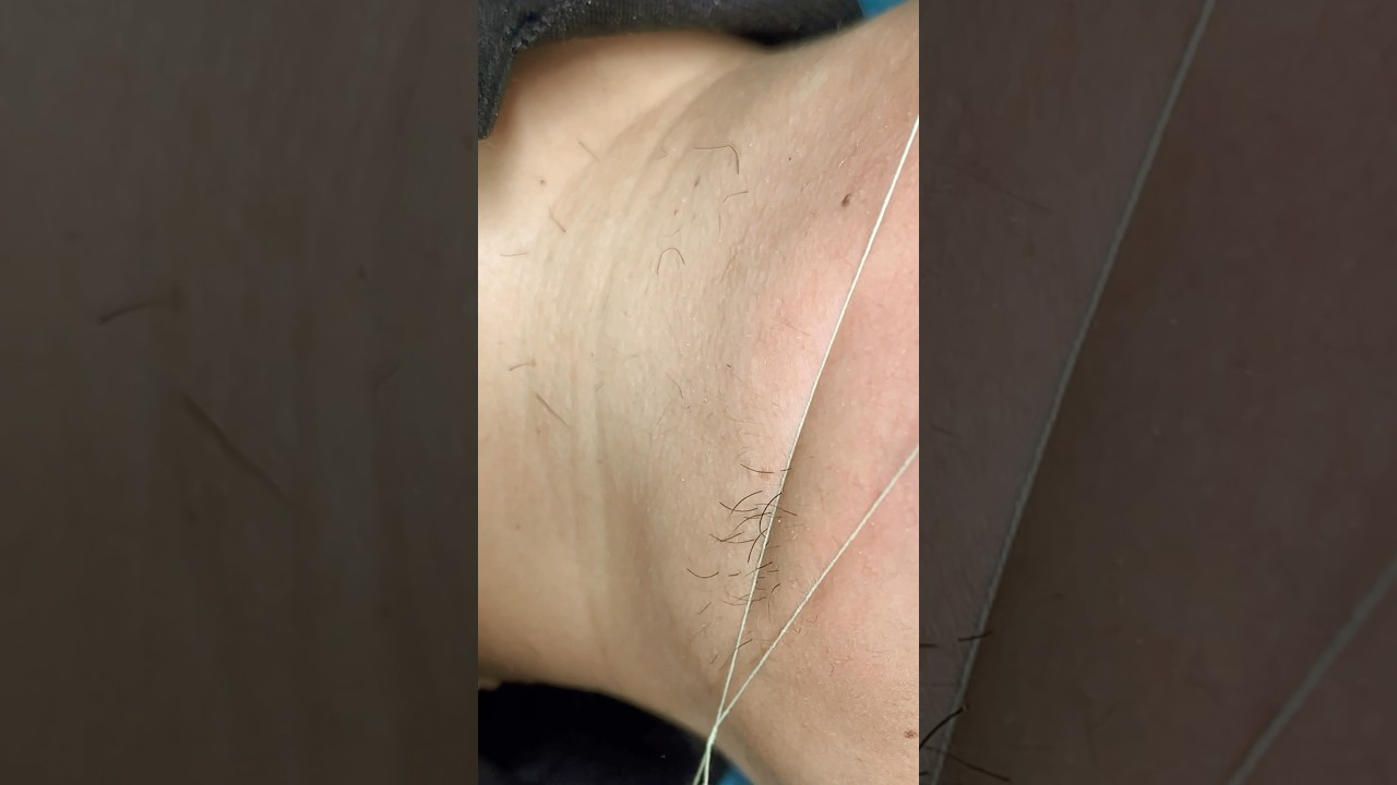Removing thick/hormonal hair under the chin with thread #threading #facethreading #hairremoval #fy