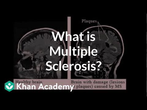 What is multiple sclerosis? | Nervous system diseases | NCLEX-RN | Khan Academy