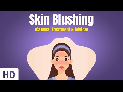 Skin Flushing or Blushing: Everything You Need To Know