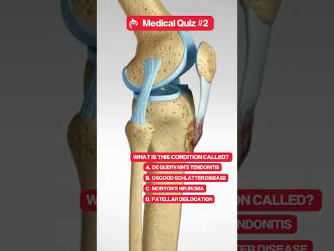 Can You Name This Medical Condition?