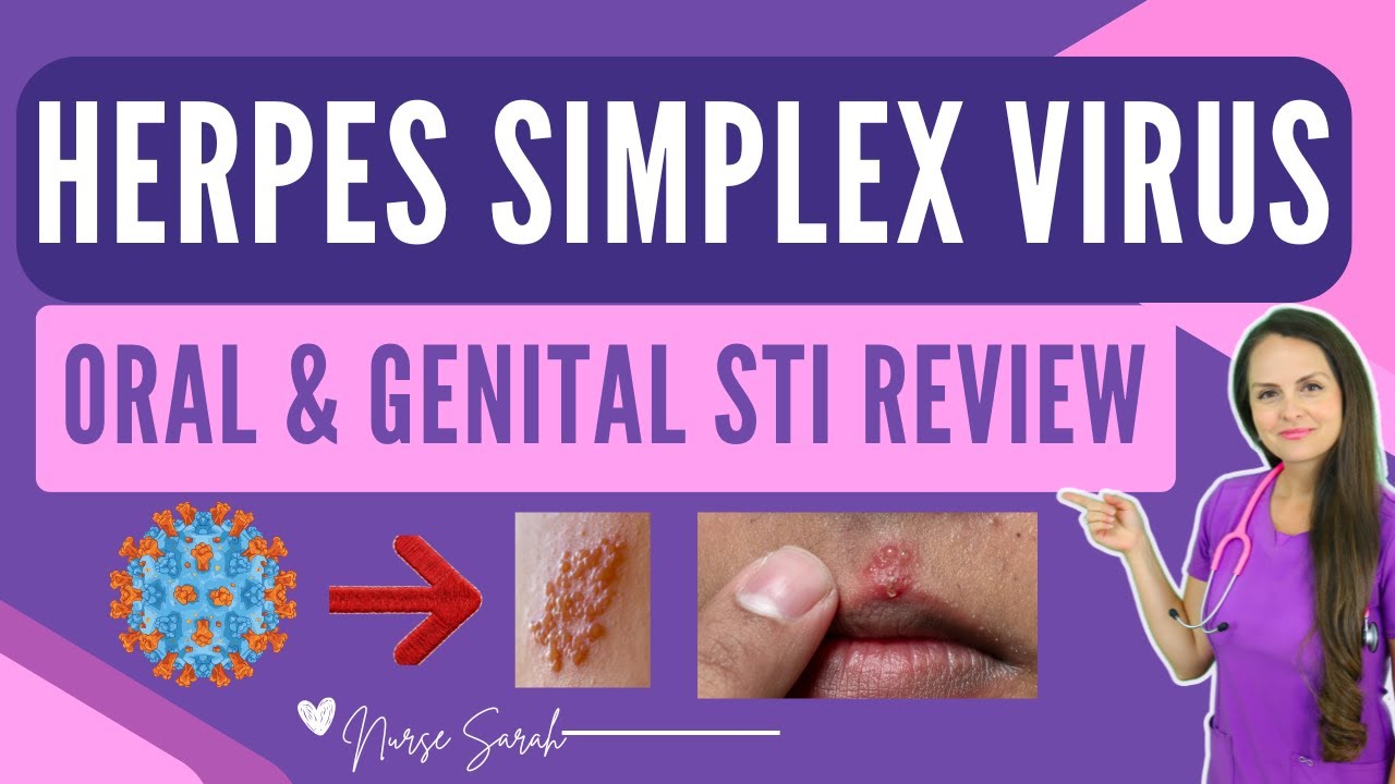 Herpes Simplex Virus (HSV-1 & 2) Nursing STI NCLEX Review | Oral and Genital Herpes