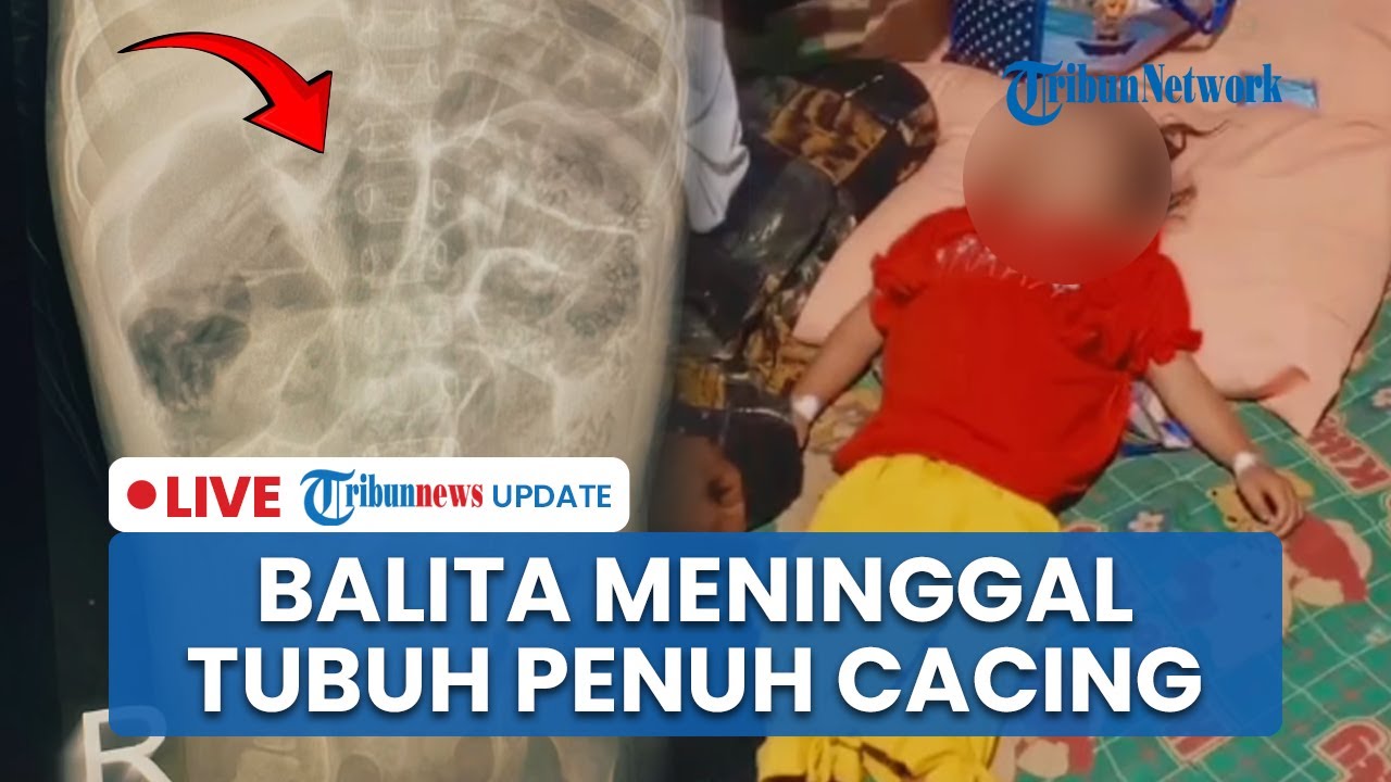 LIVE: Balita di Sukabumi Meninggal dengan Kondisi Tubuh Penuh Cacing, ibu ODGJ sementara Ayah ...