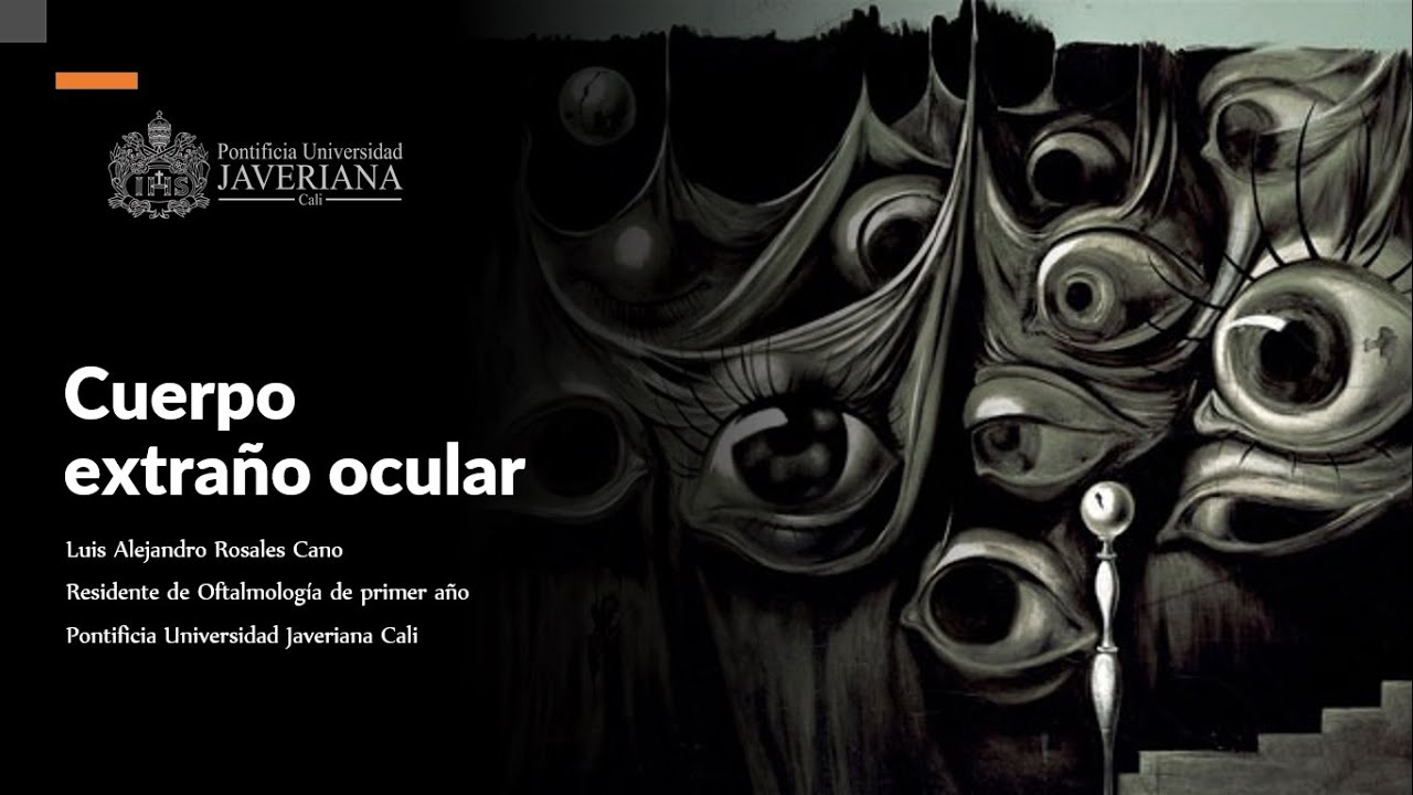 Cuerpo extraño ocular - Dr Luis Alejandro Rosales Cano
