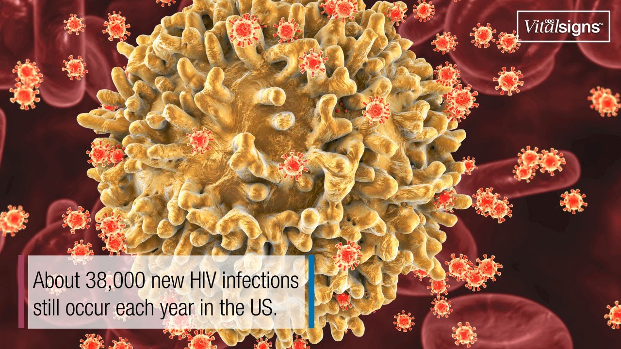How to end HIV transmission in the United States