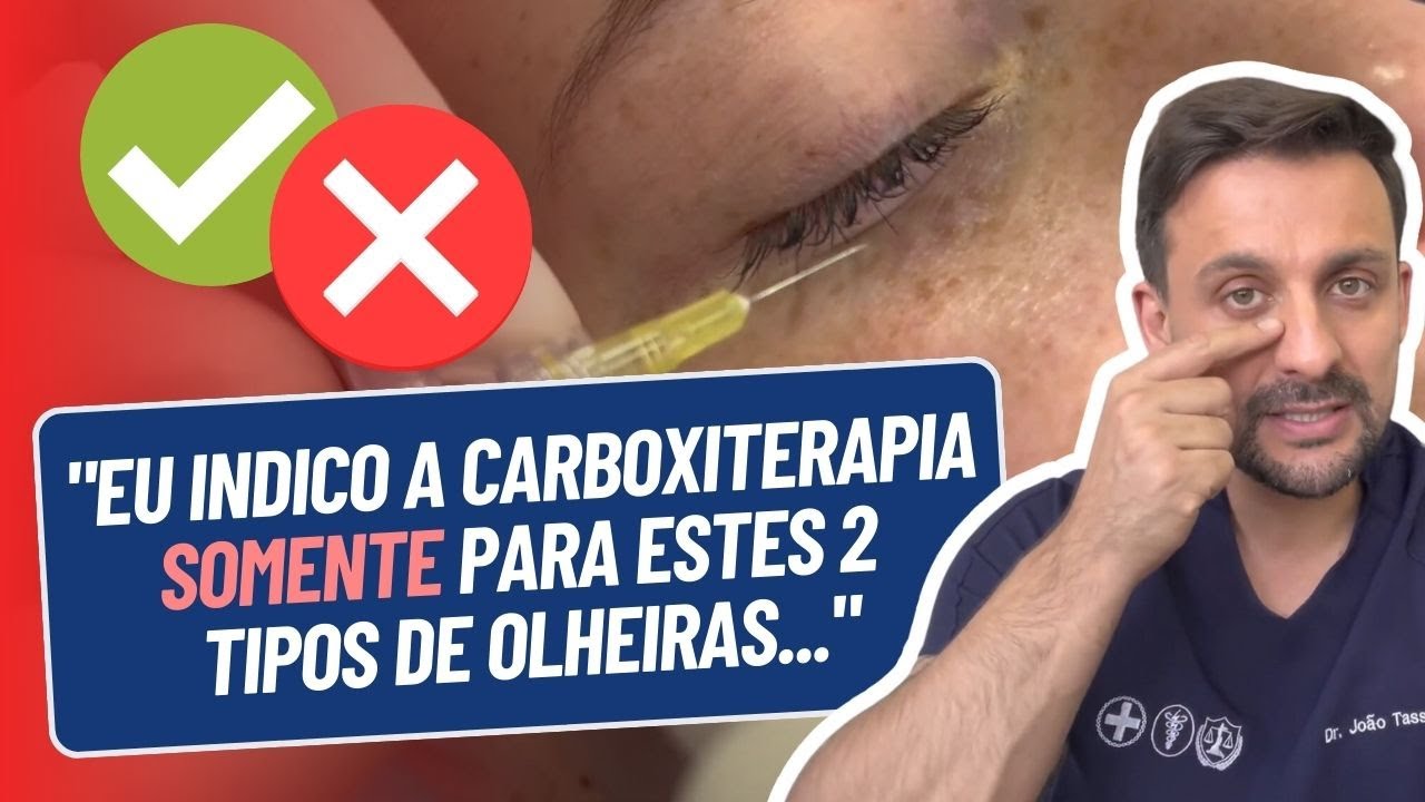 CARBOXITERAPIA FUNCIONA PARA O TRATAMENTO DE OLHEIRAS? | DR. JOÃO TASSINARY