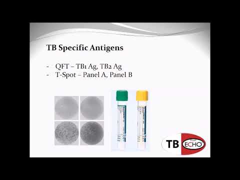 QFT and T SPOT TB Tests What do the numbers mean?