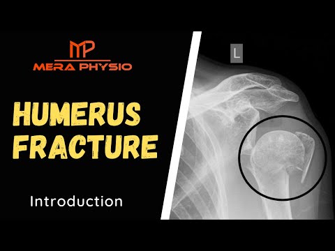Humerus Fracture | Introduction | In Hindi | Mera Physio