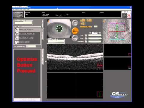 RS-3000L Scan