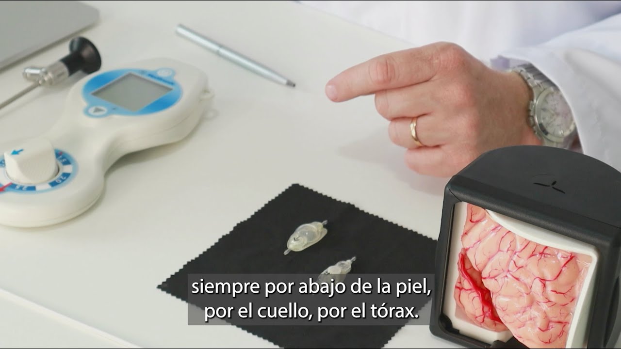 Hidrocefalia: sintomas y tratamiento. Dr. Matias Baldoncini