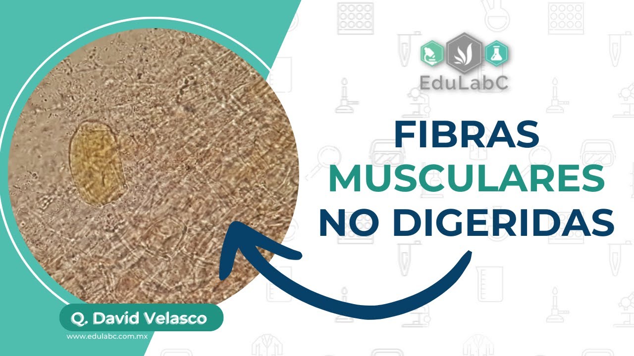 🔬 Laboratorio Clínico: Fibras musculares no digeridas