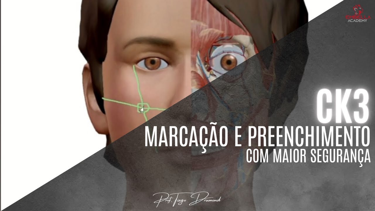 CK3 - Marcação e preenchimento com maior segurança