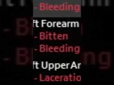When You Get Bitten In Project Zomboid...
