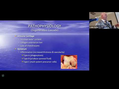From LECOM's January 2025 CME: The Arthritic Knee
