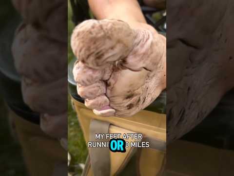Incredible Feet Reveal After Race of 100 Miles 😲🫣 #shorts