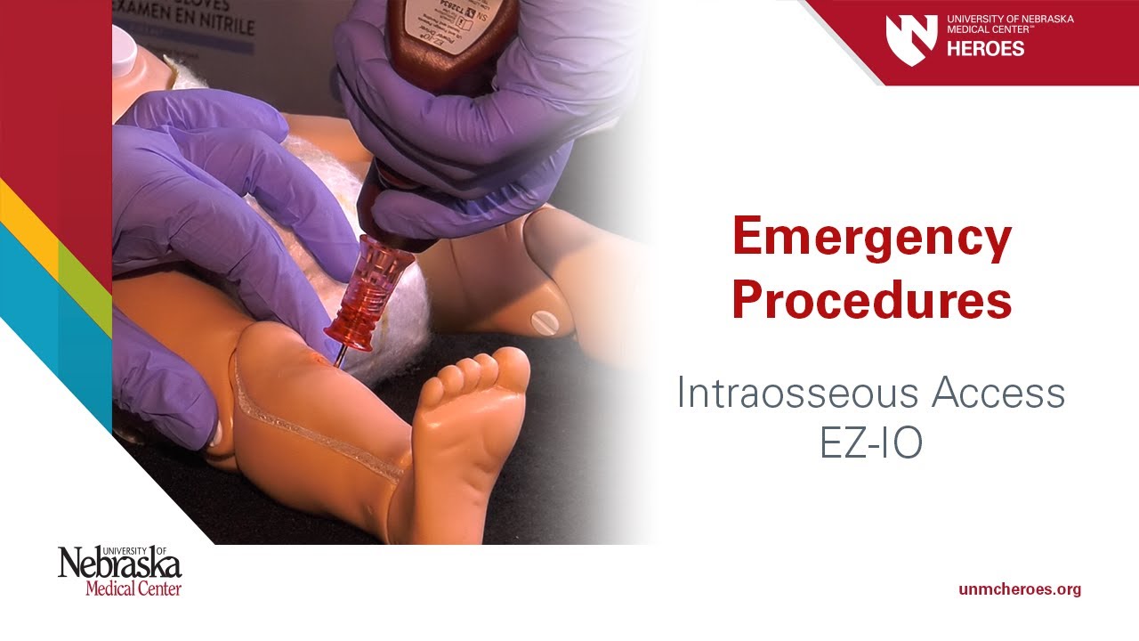 Emergency Procedures: Intraosseous Access - EZ-IO
