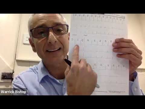 EP133: Funny Beats In The Heart - Ventricular Ectopic Beats