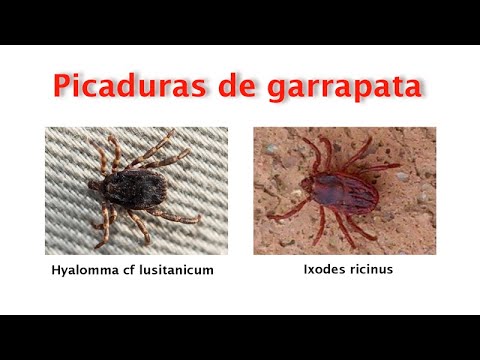 17 - Picaduras de garrapatas.