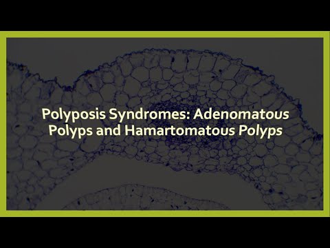 Polyposis Syndromes: Adenomatous Polyps and Hamartomatous Polyps