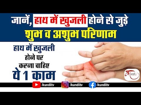 जानें, हाथ में खुजली होने से जुड़े शुभ व अशुभ परिणाम | हाथ में खुजली होने पर करना चाहिए ये 1 काम