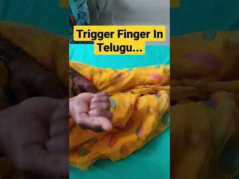 Trigger Finger In Telugu...Dr Sai Chandra MBBS DNB Ortho