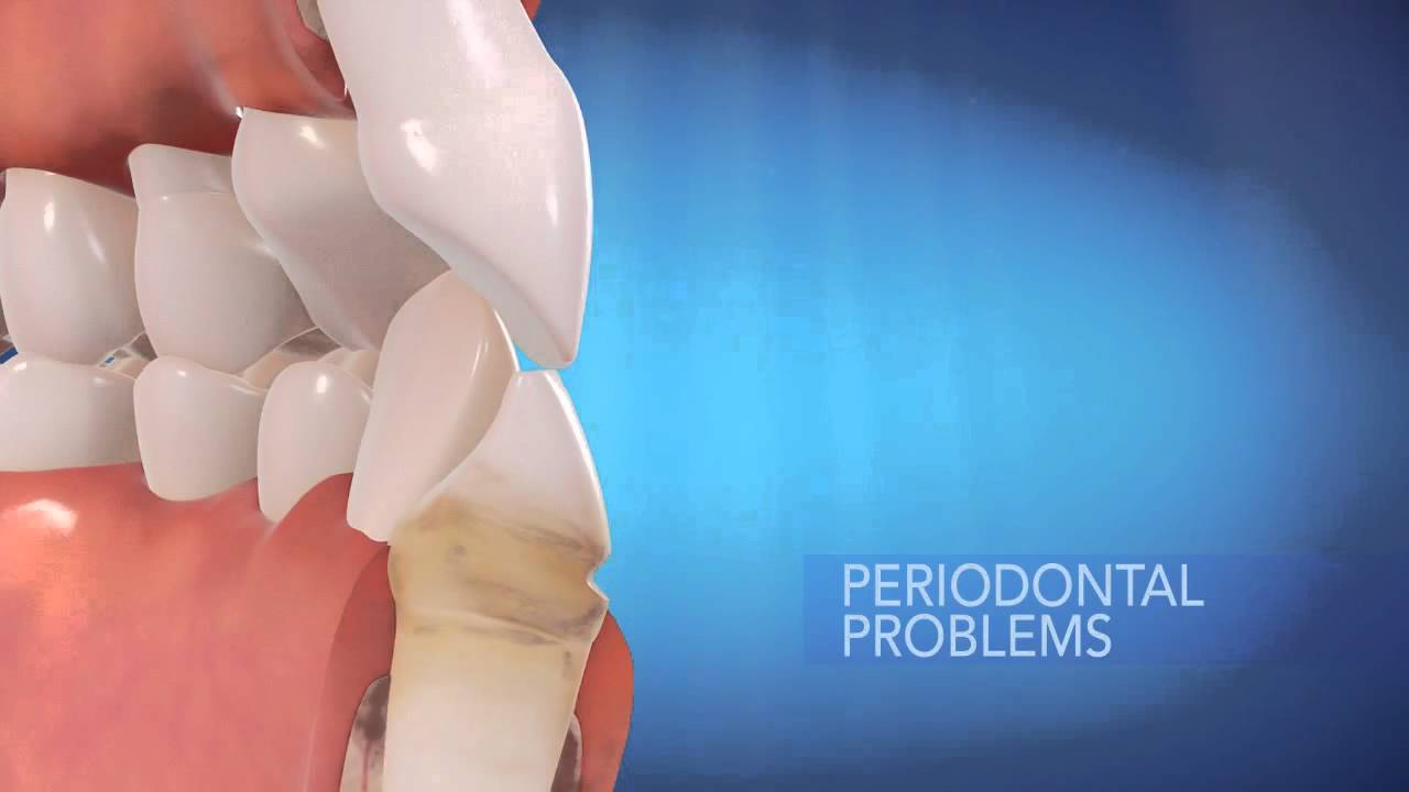 Durham Orthodontics Invisalign Treatment Whitby Ontario