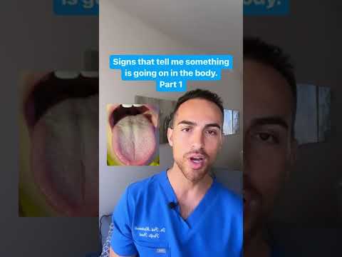 White coat on tongue common causes. #shorts #guthealth #candida #yeast #foodsensitivities