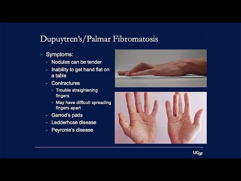 Lumps and Bumps of the Hand and Wrist