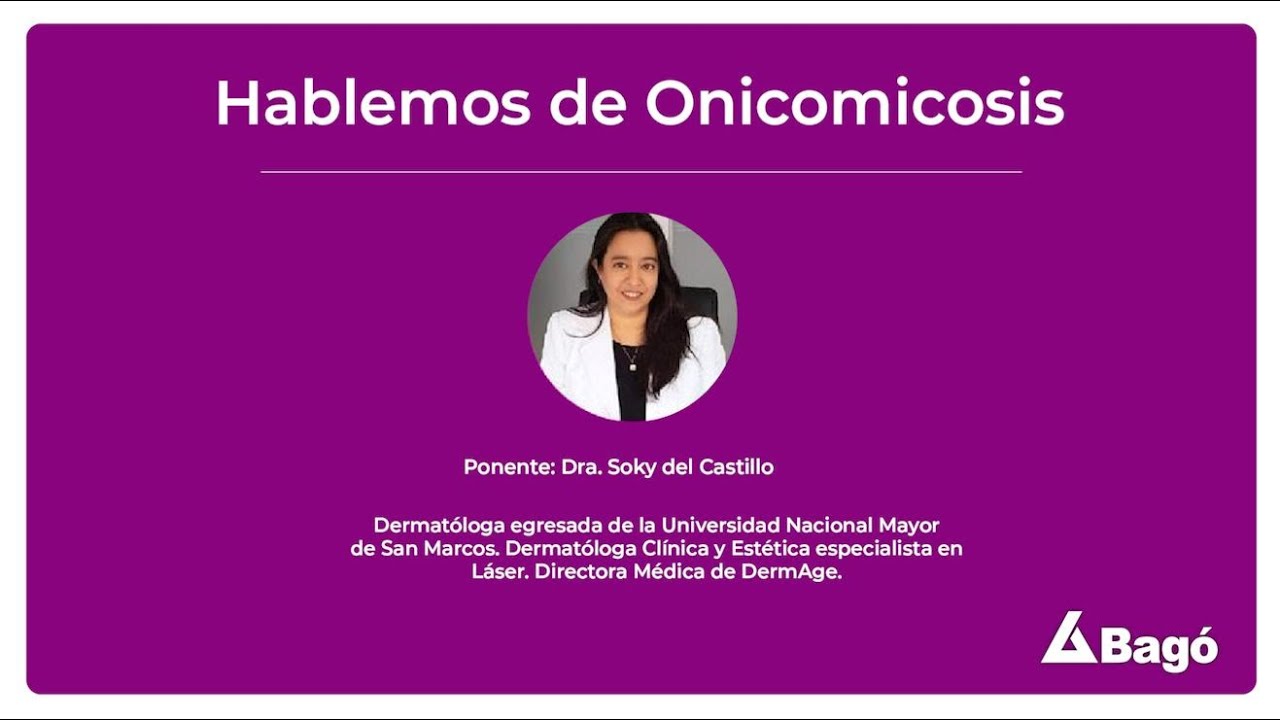 HABLEMOS DE ONICOMICOSIS