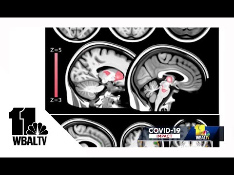 Study: COVID-19 infection causes brain tissue damage