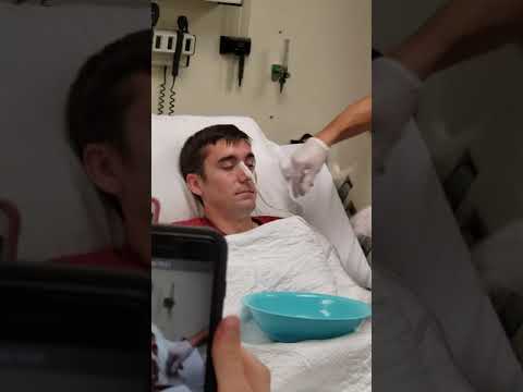 Insertion of Nasogastric (NG) tube