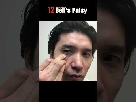 9th Point of Bell's Palsy Massage for Eye Movement #bellspalsy #facialparalysis #selfcare