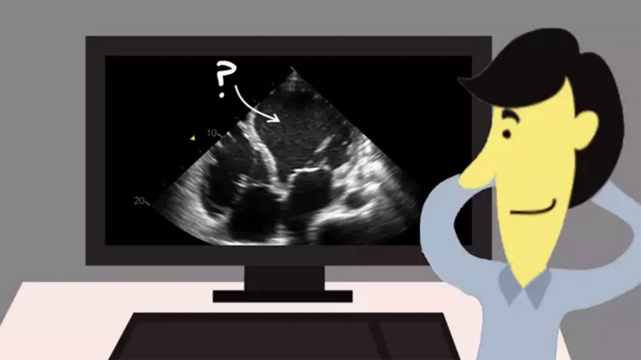 How to become an echo expert!